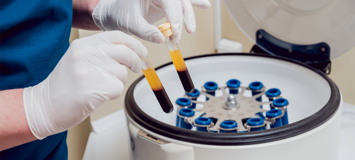 Regenerative Medicine Vail, CO - Vail Orthopedic Surgery